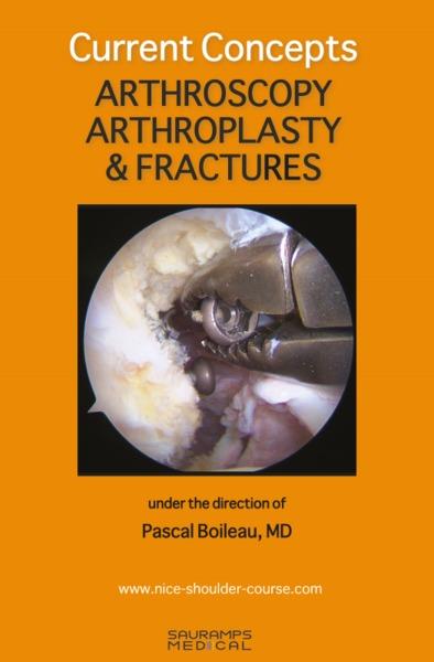 Current concepts. arthroscopy, arthroplasty & fractures - coll nice shoulder (Boileau Pascal)